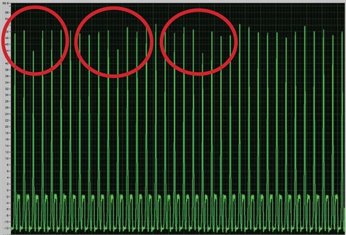 Why Your Approach to Diagnosing BMW Cars Matters: Part 1
